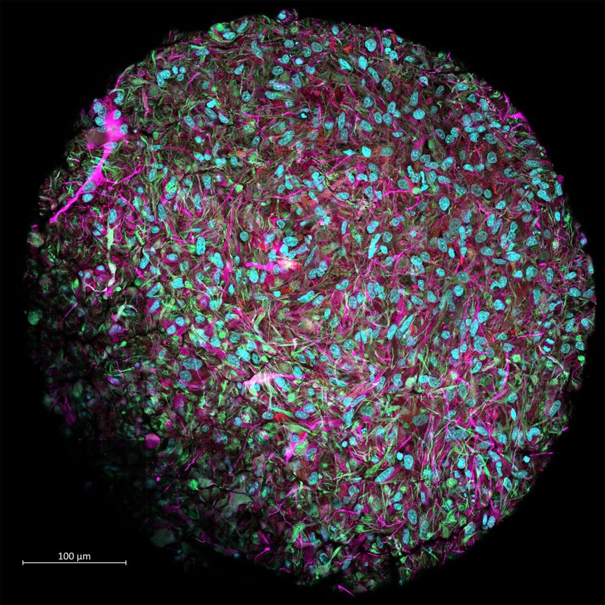 Organoid Intelligence (OI) Masa Depan Kecerdasan Buatan yang Lebih ...